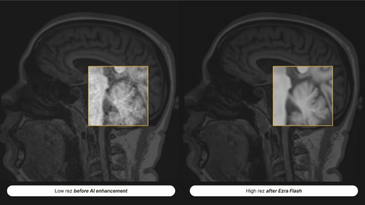 Ezra Raises Another $21M for Full Body MRIs Powered by AI That Makes ...
